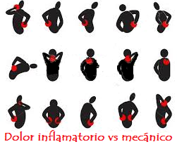 Dolor inflamatorio vs mecánico: ¿sabes diferenciarlos? | Dra. Herraiz ...